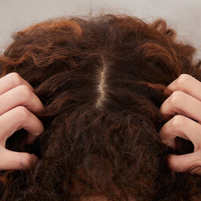 Scalp Care Guide: Routine, Treatments, and Tips - Garnier