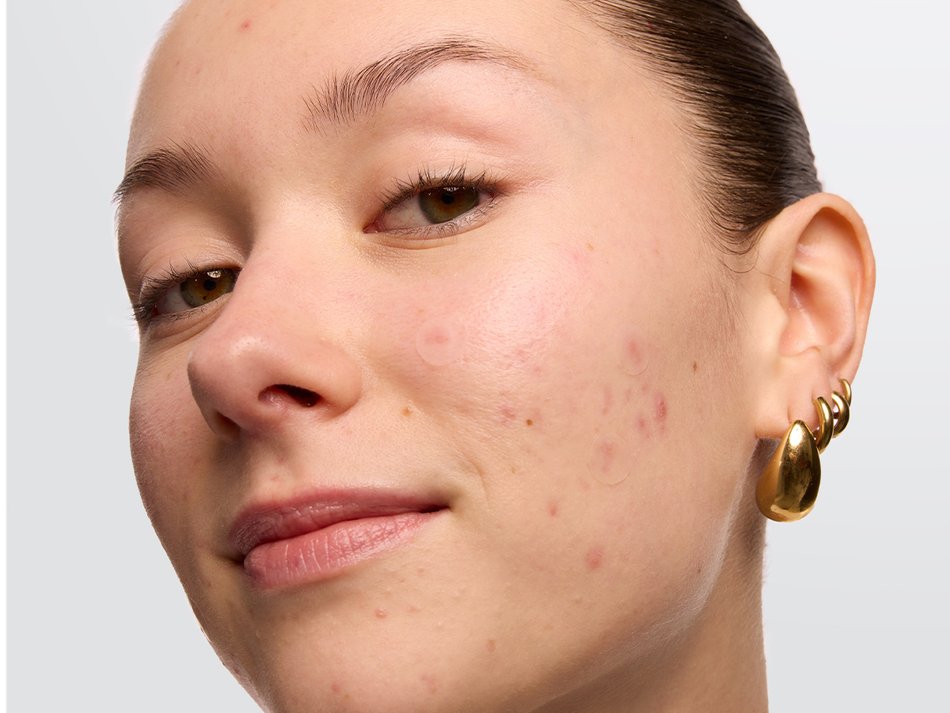 Skin Care for Teens and Tweens: A Guide for Clear Skin - Garnier