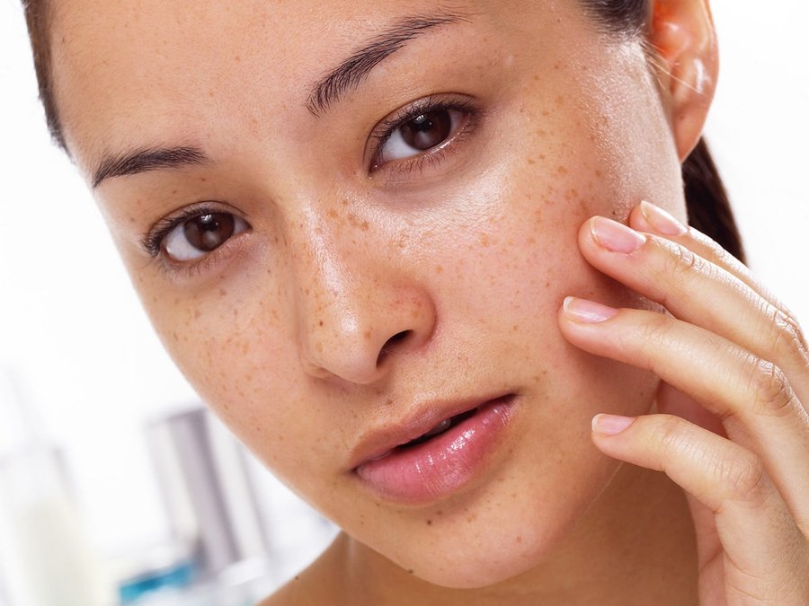 Skin Care for Sensitive Skin - Tips & Products | Garnier